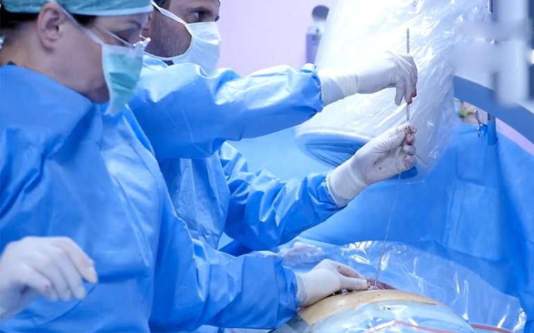 Endoscopic Rhizotomy – CENTRE FOR ENDOSCOPIC AND MICROSCOPIC SPINE AND ...